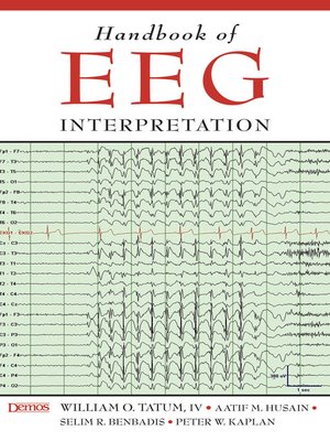 Handbook of EEG Interpretation by Selim R. Benbadis · OverDrive: Free ...