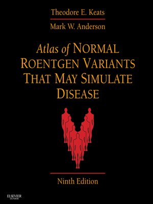 Atlas of Normal Roentgen Variants That May Simulate Disease E-Book by ...