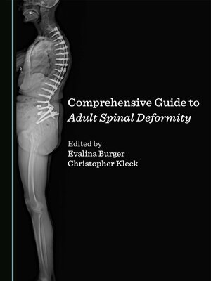 Comprehensive Guide to Adult Spinal Deformity by Evalina Burger ...